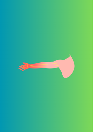 AIN Syndrome: Pathophysiology, Diagnosis, & Treatment