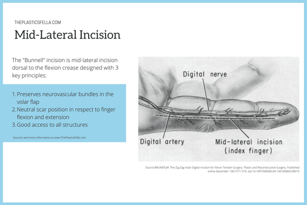 Volar Incisions – Bruner, Mid-lateral & others