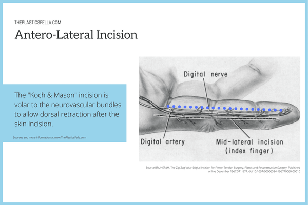 Volar Incisions – Bruner, Mid-lateral & others