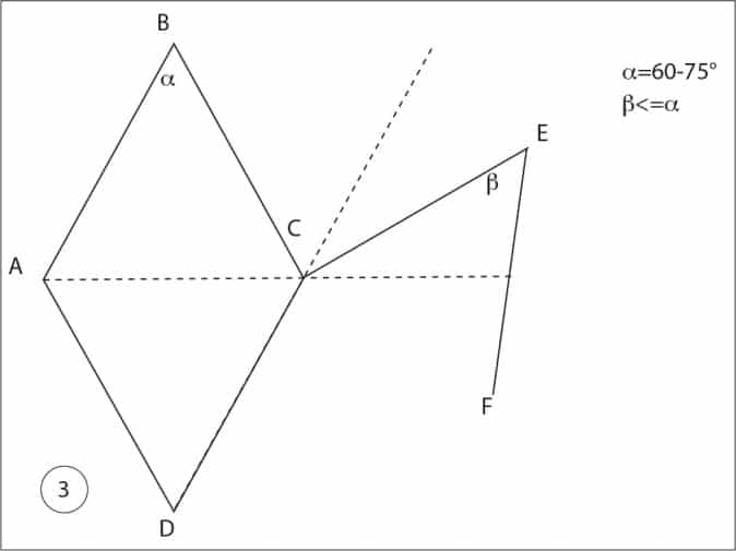 Rhomboid Flap - Indications, Design, Examples