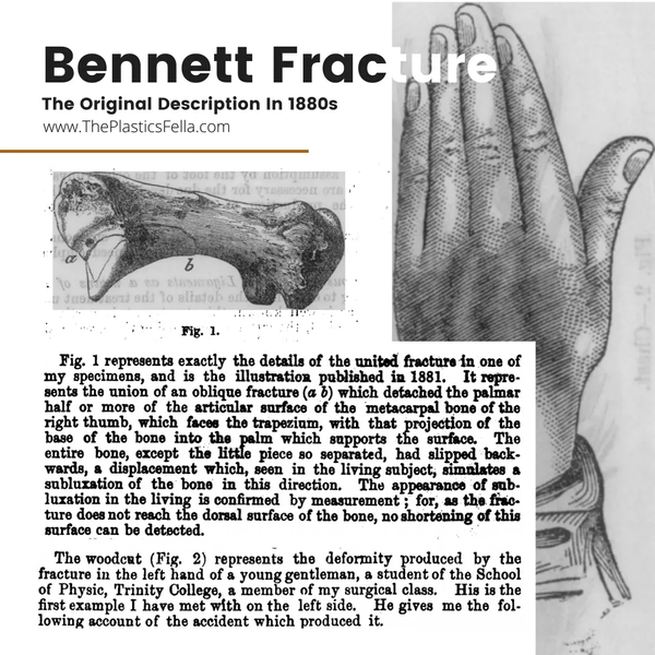 Bennett Fracture - X-Rays, Diagnosis, Treatment.