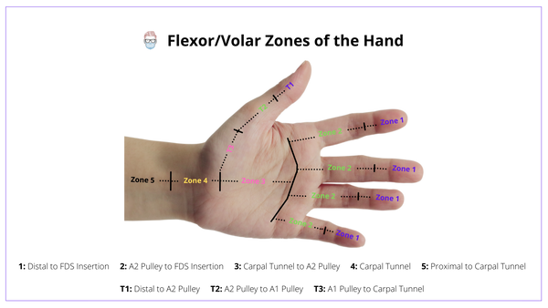 Zones of the Hand (Flexor and Extensor)
