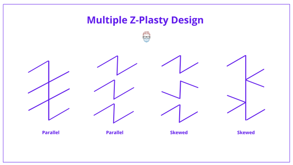 Z-Plasty: Designs, Indications, Variations and Complications