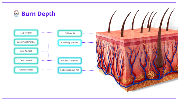 Burn Depth - Classification, Assessment, Characteristics.
