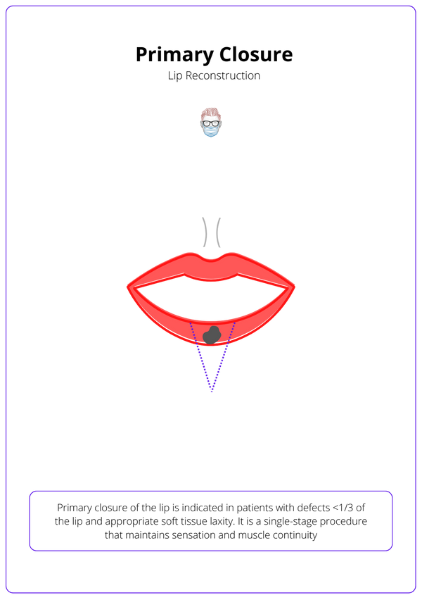 Lip Reconstruction: Anatomy, Indications, & Algorithm