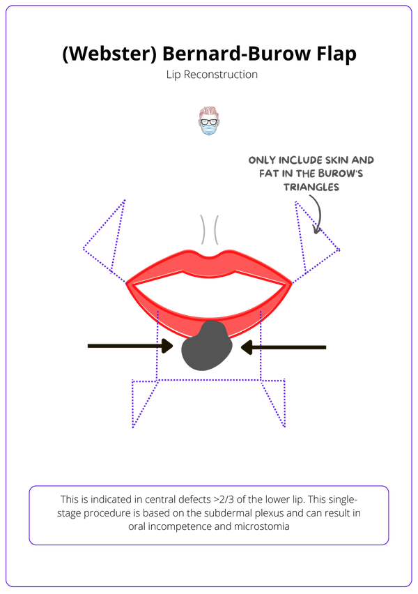 Lip Reconstruction: Anatomy, Indications, & Algorithm