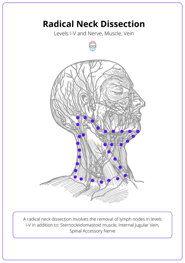 Neck Dissection: Types, Anatomy, Indications, Complications