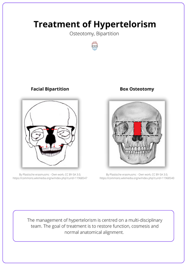 Hypertelorism: Definition, Classifying, Causes, & Treatment