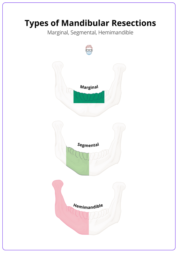 Mandibular Defects · Classification & Reconstruction