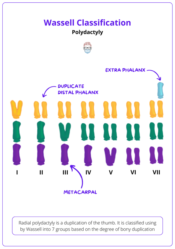 Polydactyly: Classification & Treatment