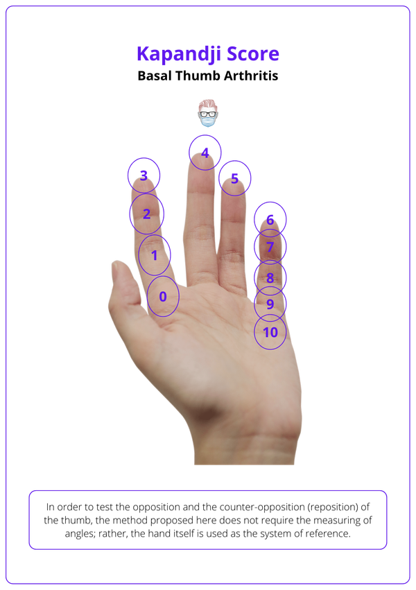 Basal Thumb Osteoarthritis: Anatomy, Pathophysiology, Diagnosis, Treatment