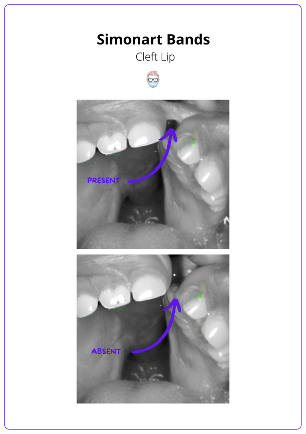 Cleft Lip - Clinical Cases
