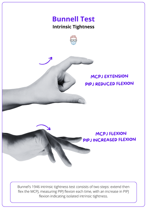 Intrinsic "Plus" Hand: Anatomy, Aetiology, and Management