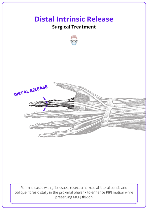 Intrinsic "Plus" Hand: Anatomy, Aetiology, and Management