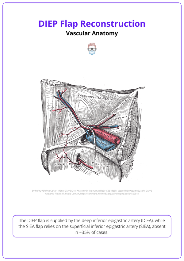 DIEP Flap Reconstruction: Anatomy, Key Surgical Steps, & Complications